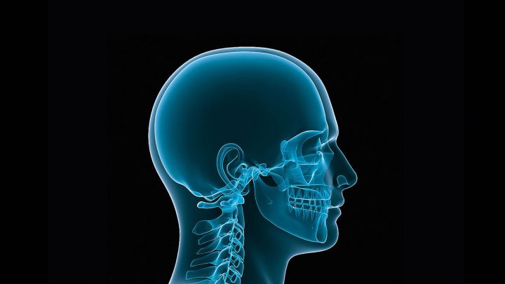 Skull base – SANHOS